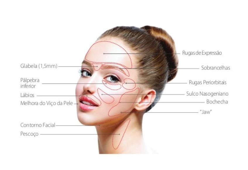 Ultrassom Microfocado Digital em São Paulo - Clínica Eliza Minami.